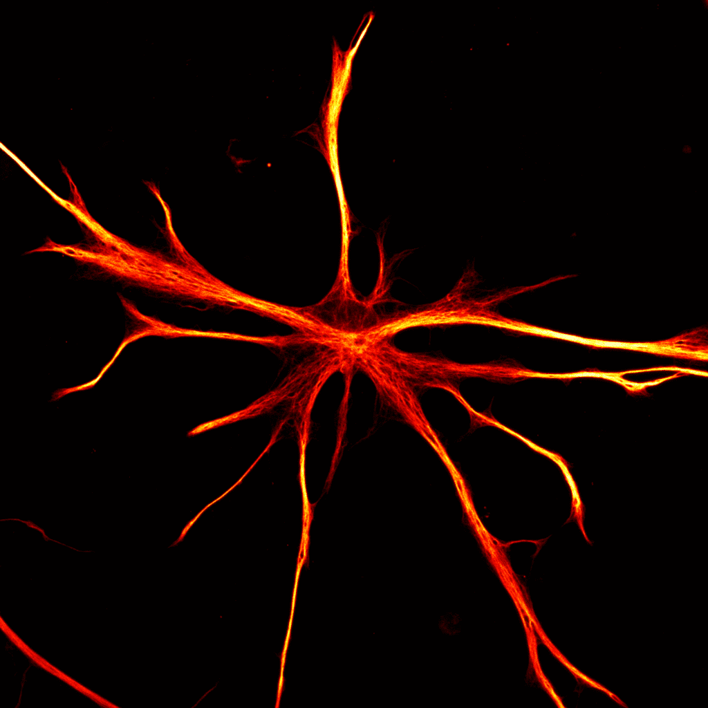 When Astrocytes Attack: Stem Cell Model Shows Possible Mechanism Behind ...
