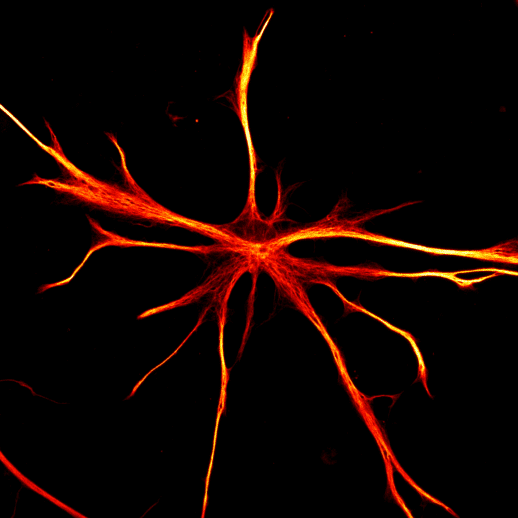 When Astrocytes Attack: Stem Cell Model Shows Possible Mechanism Behind ...