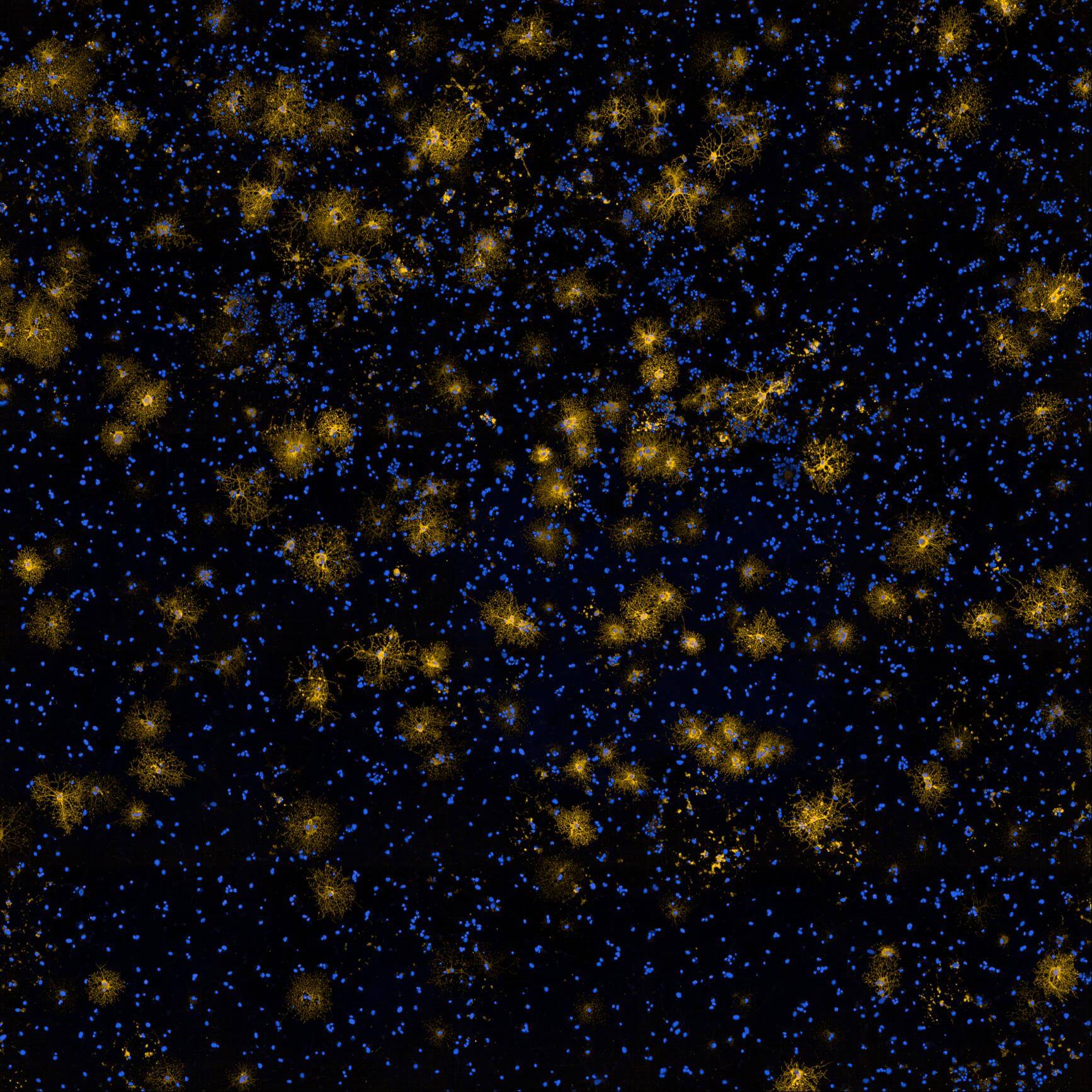 A Clearer Window Into Disease: Meet the Opera Phenix Microscope - New ...