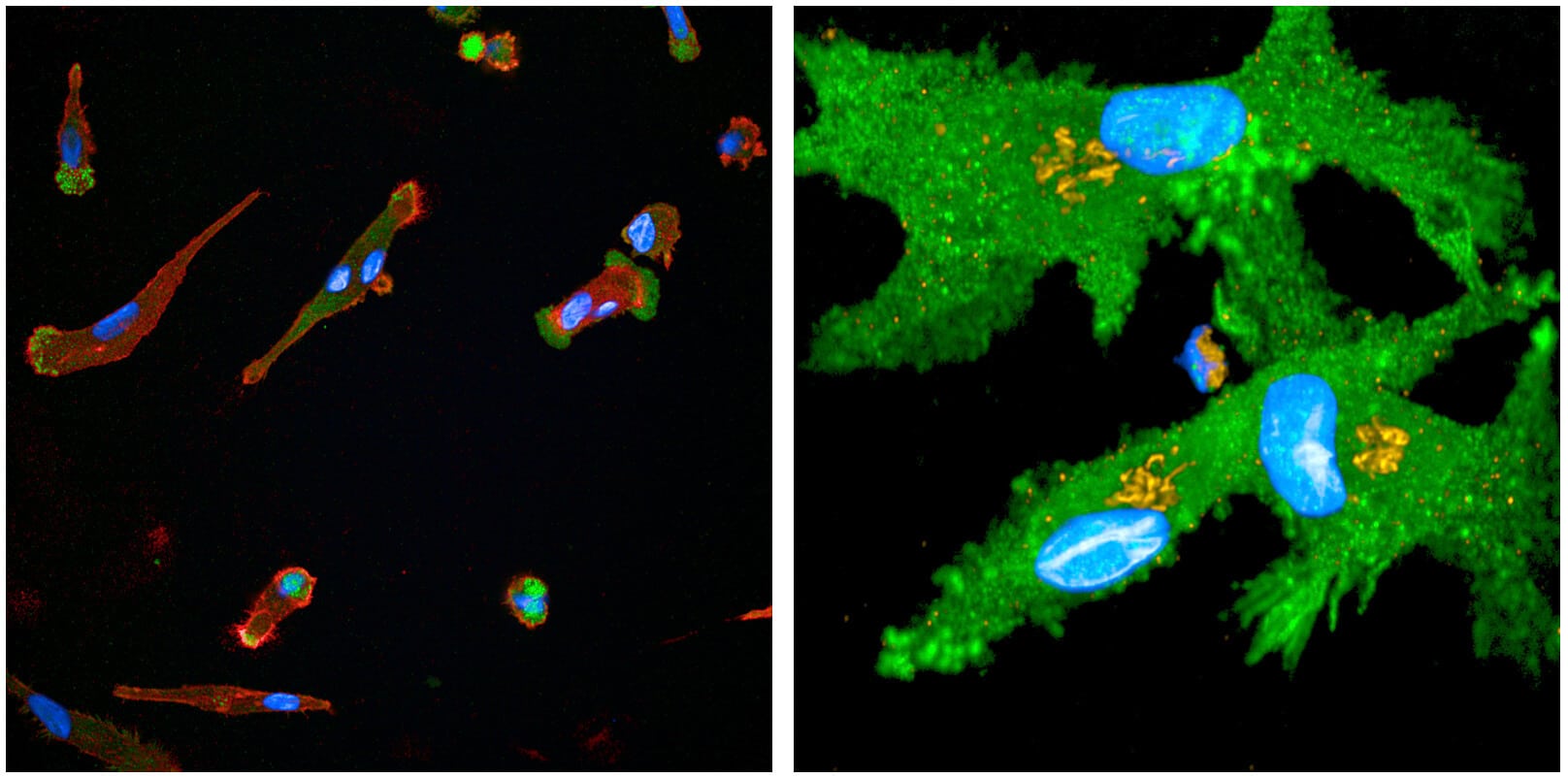 A Clearer Window Into Disease: Meet the Opera Phenix Microscope - New ...