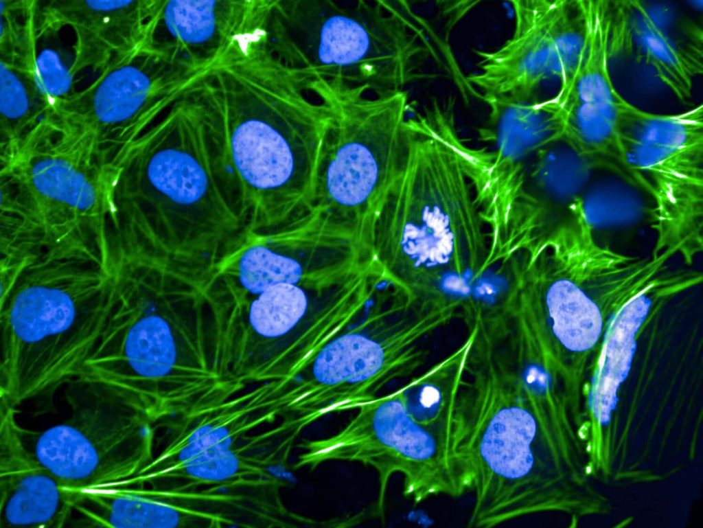 A Clearer Window Into Disease: Meet the Opera Phenix Microscope - New York Stem Cell Foundation