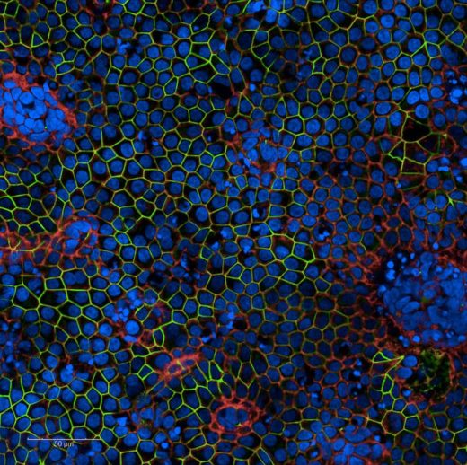 A Clearer Window Into Disease: Meet the Opera Phenix Microscope - New York Stem Cell Foundation