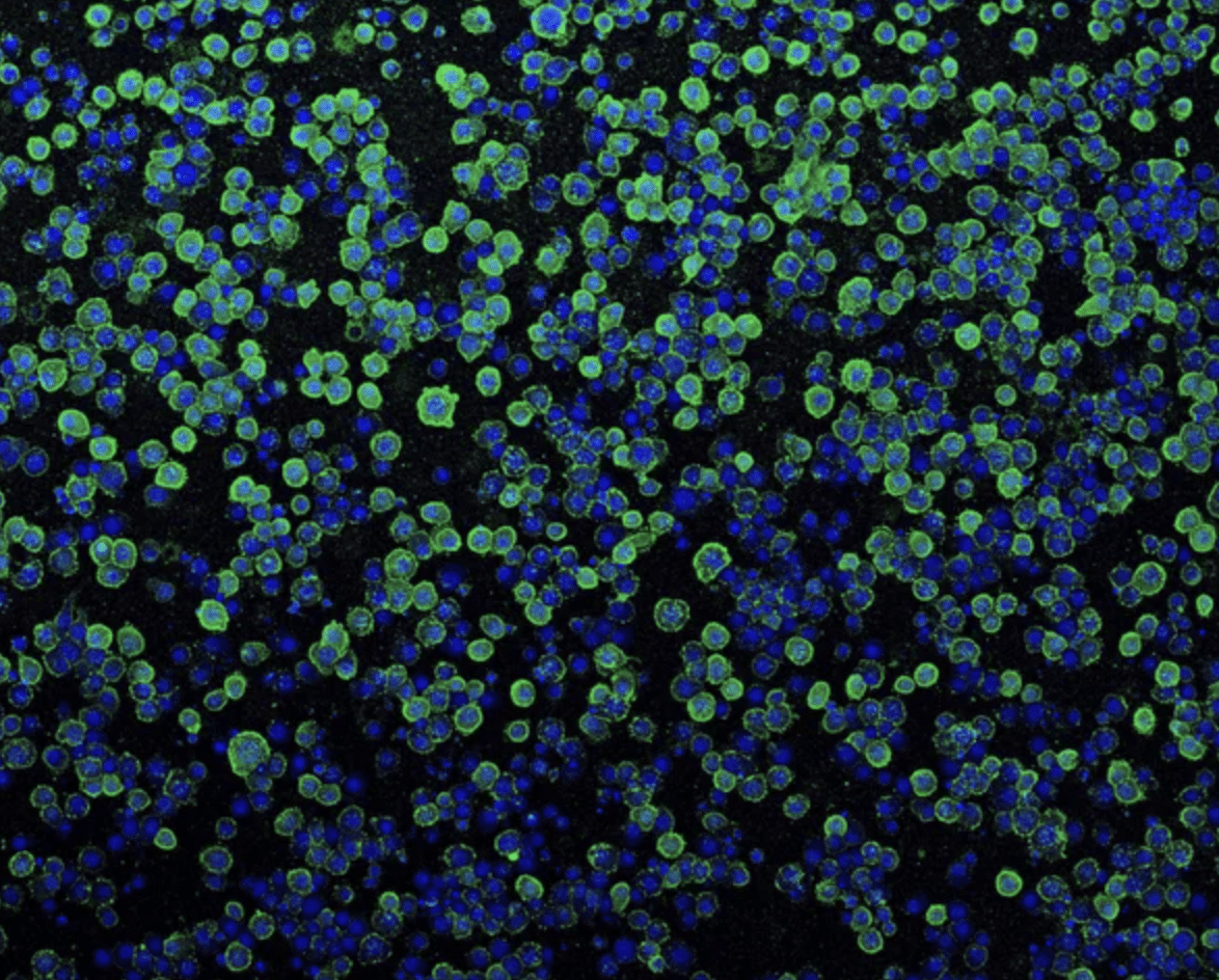 Meet the Nano-Syringe that Could Revolutionize Gene Therapy - New York ...